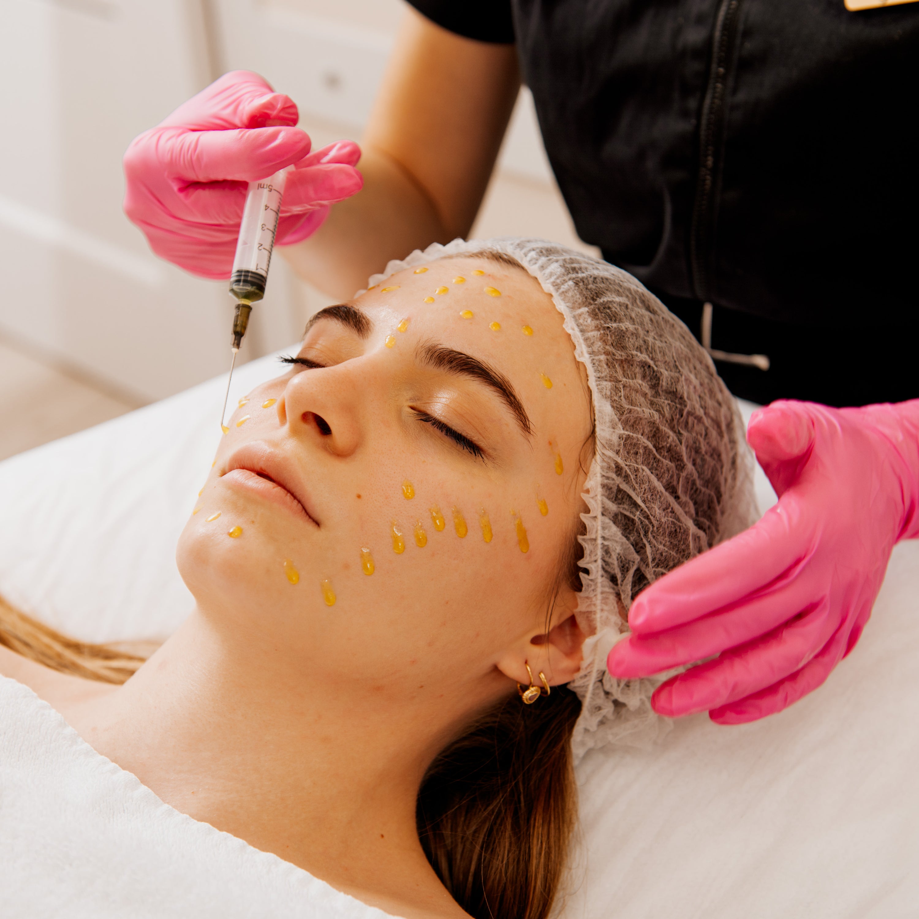 Is Microneedling Safe? Understanding the Risks and Benefits – ReGlow